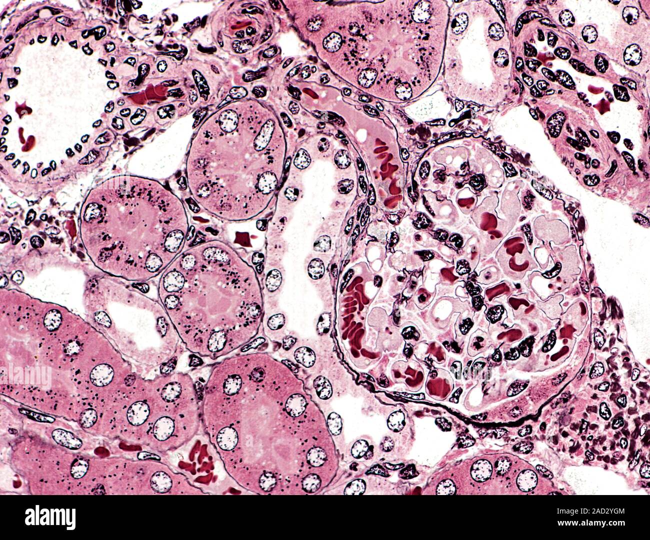 Light microscopy of a glomerulus in the kidney. Glomeruli also known as ...