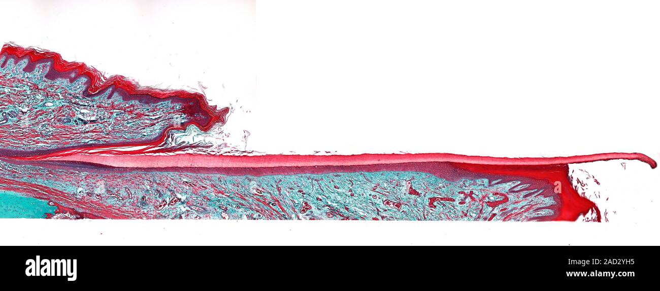 Longitudinal section through a fingernail. The nail plate itself is ...