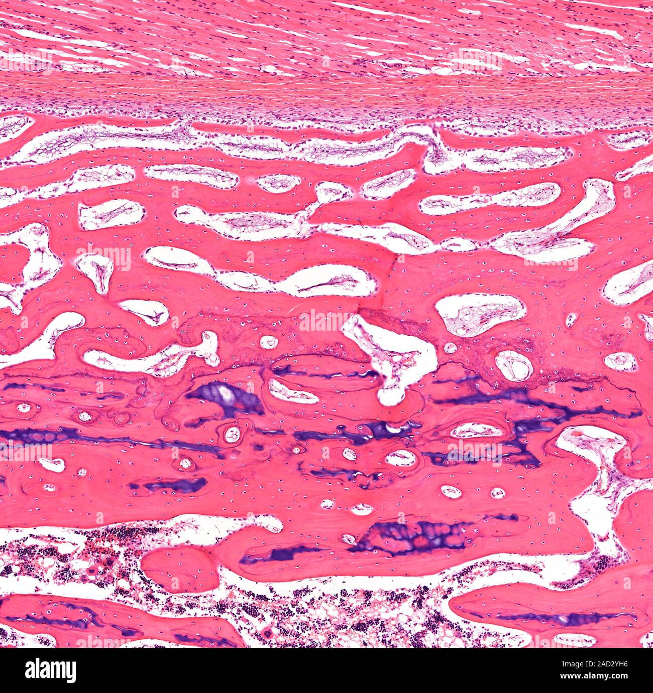 Spongy or cancellous bone is shown (pink) with cavities for bone marrow ...