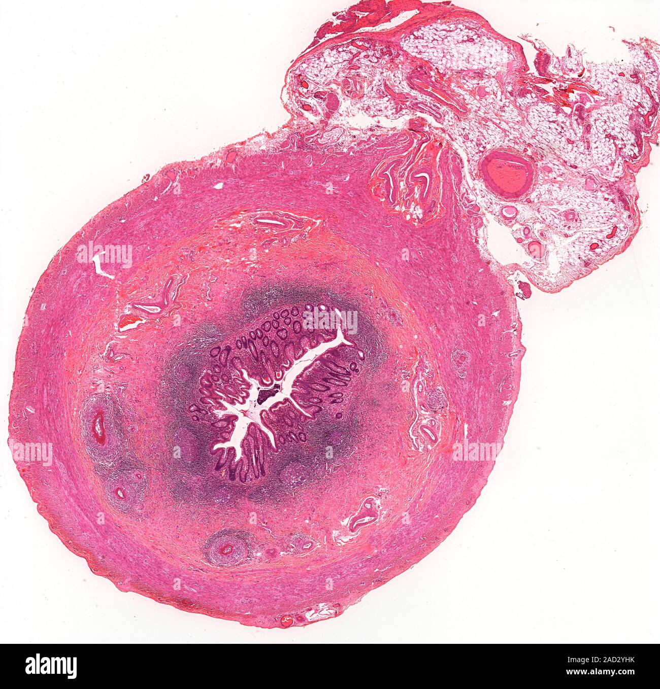 Human appendix in cross-section viewed by light microscopy. The mucosa ...