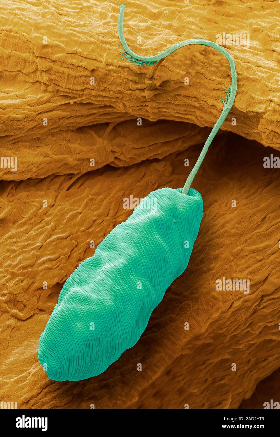 Euglena flagellate protozoan. Coloured scanning electron micrograph ...