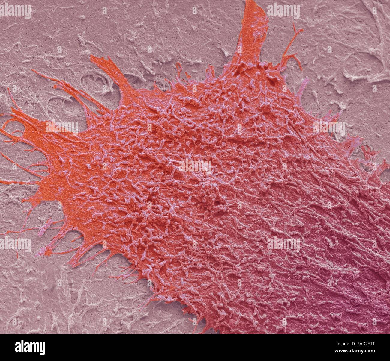Keratinocyte skin cell. Coloured scanning electron micrograph (SEM) of ...