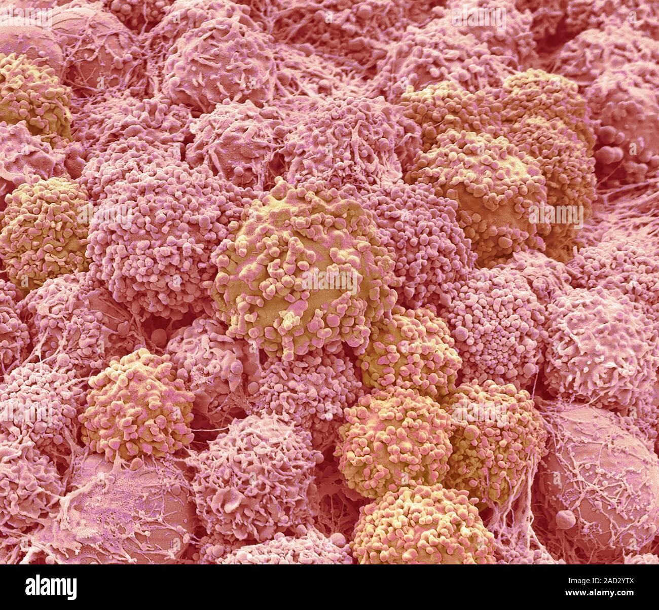 Coloured scanning electron micrograph (SEM) of neural stem cells from a ...