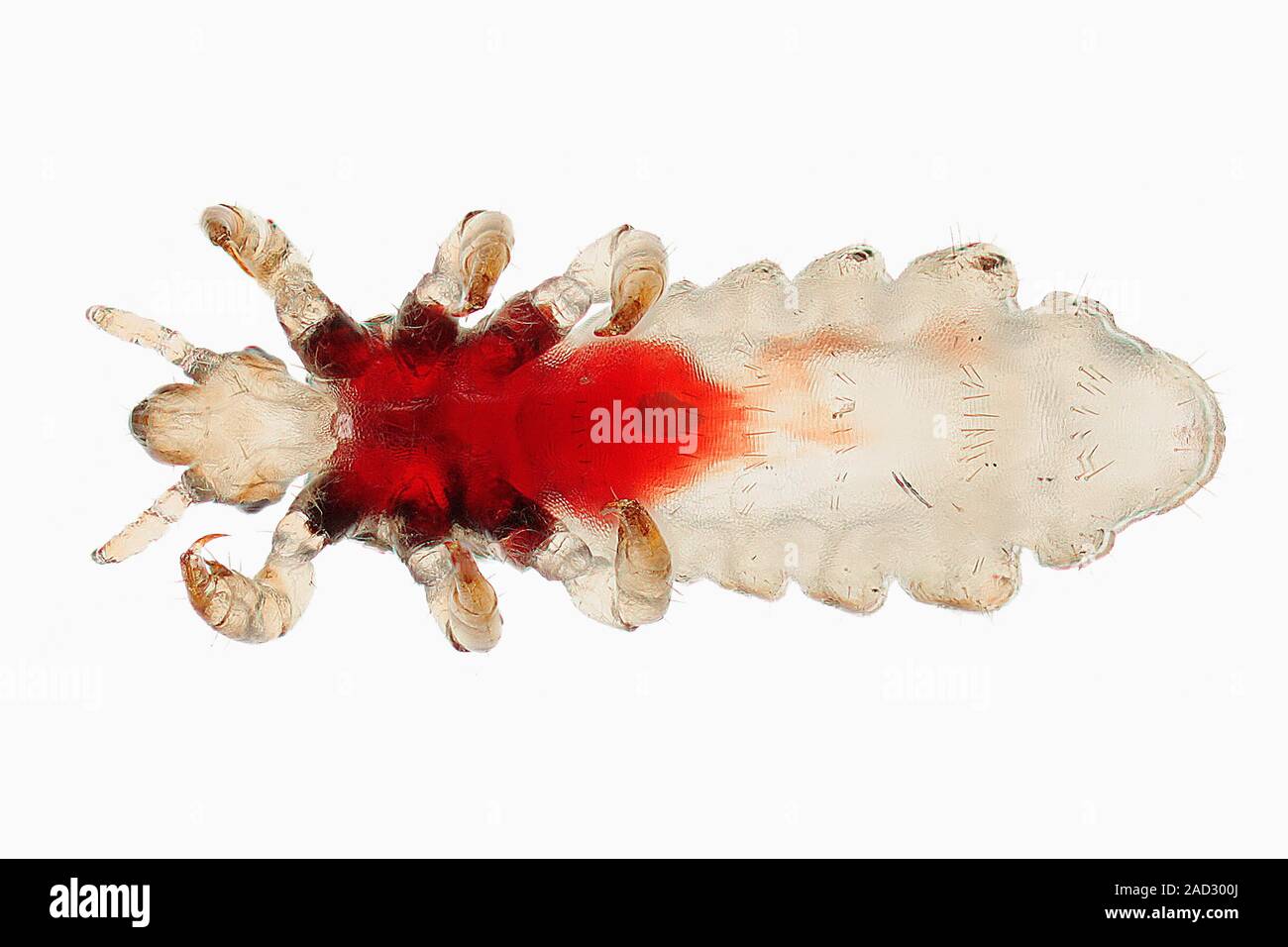 Head louse (Pediculus humanus capitis), light micrograph. Head lice ...