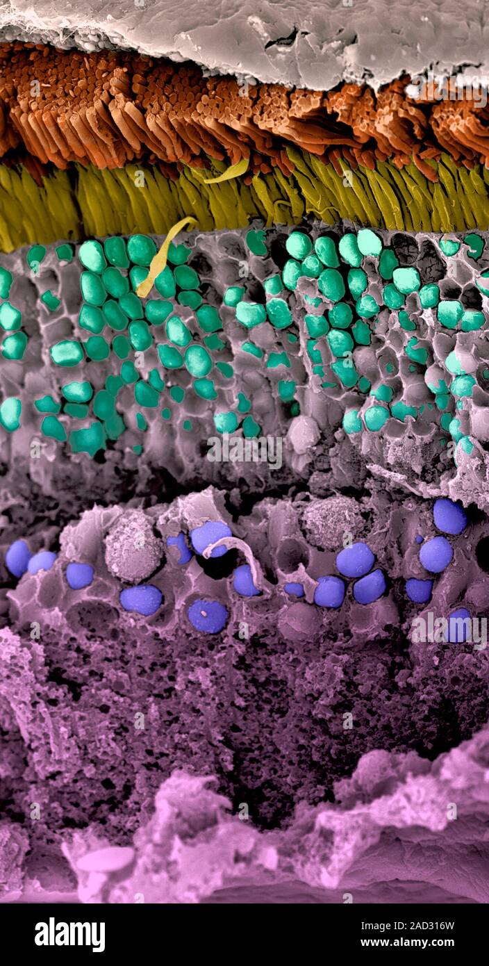 Retina of the eye. Coloured scanning electron micrograph of a section ...