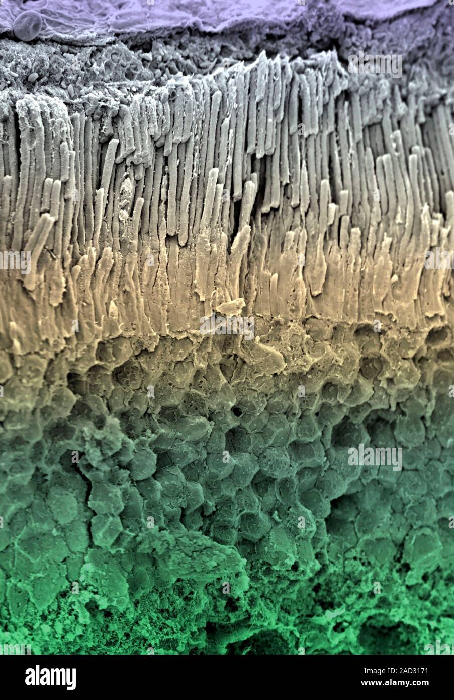 Retina of the eye. Coloured scanning electron micrograph of a section ...