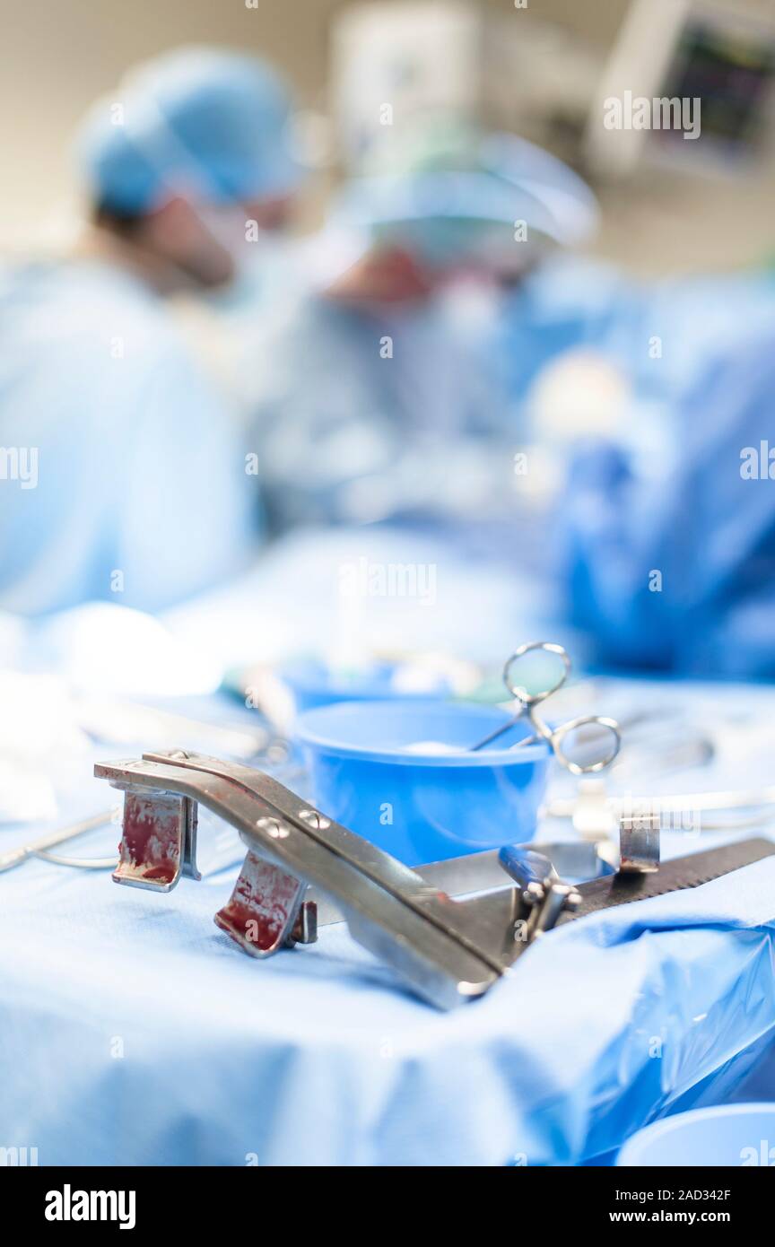 Surgical clamps. Close-up of surgical clamps being used during an ...