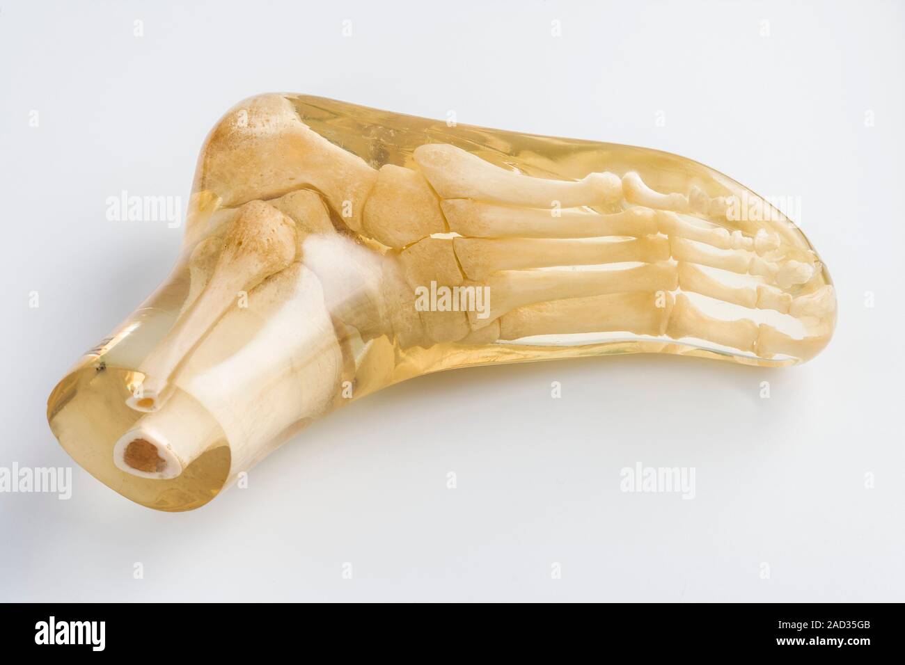 Foot and ankle bones in resin. This cast is used in X-ray studies Stock ...