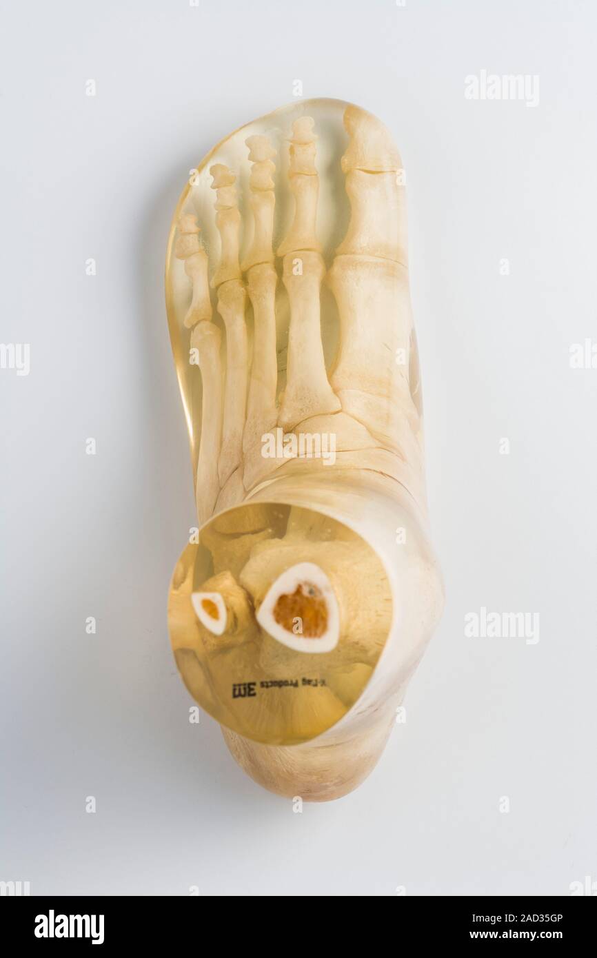 Foot and ankle bones in resin. This cast is used in X-ray studies Stock ...