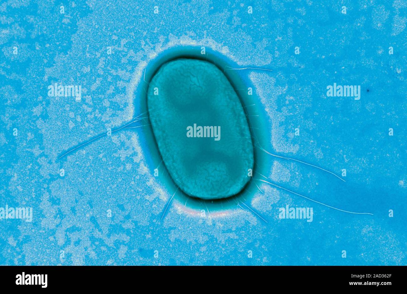 E. coli O55 bacterium. Coloured transmission electron micrograph (TEM ...