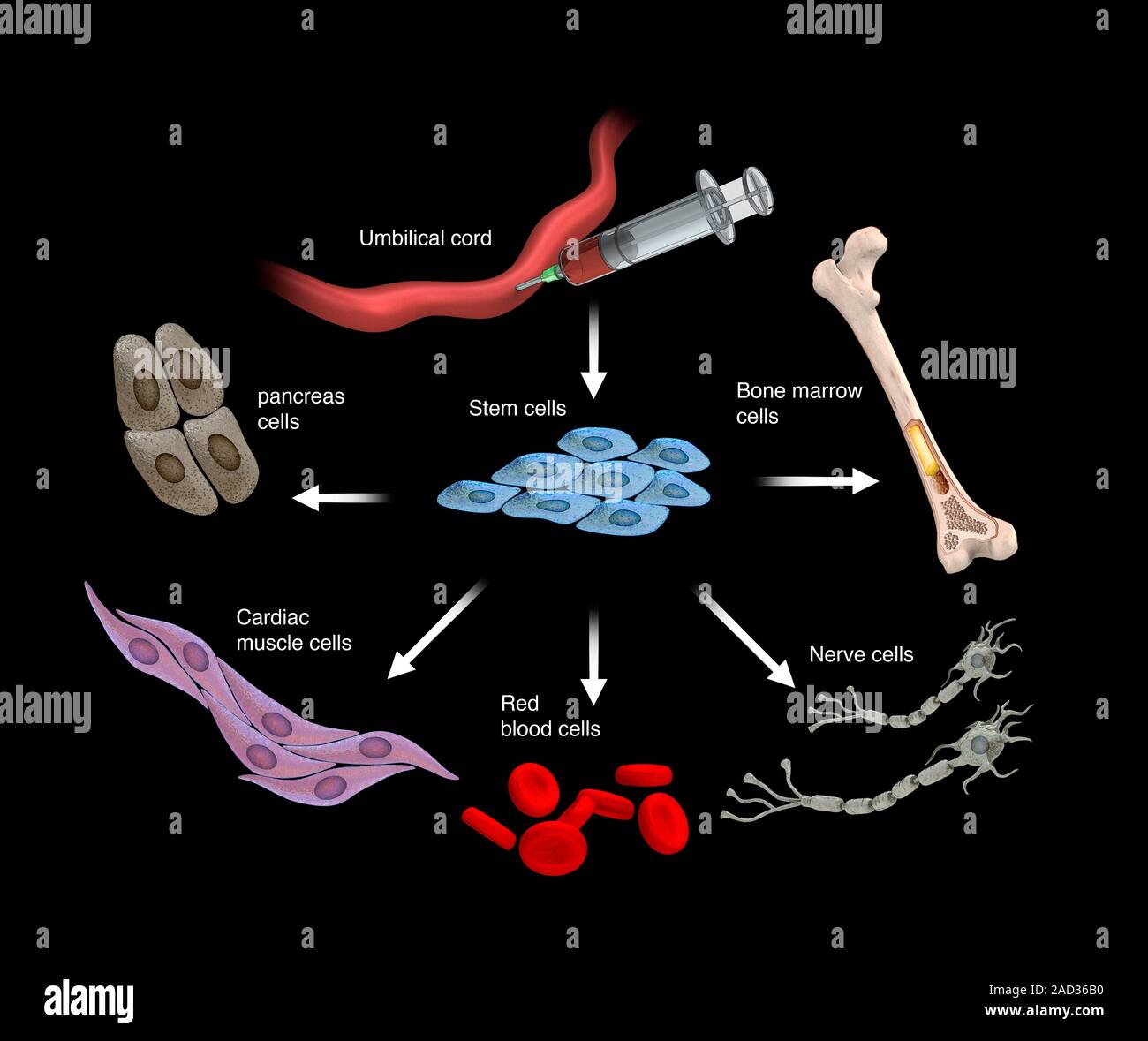 Collection and use of umbilical stem cells. Computer illustration ...