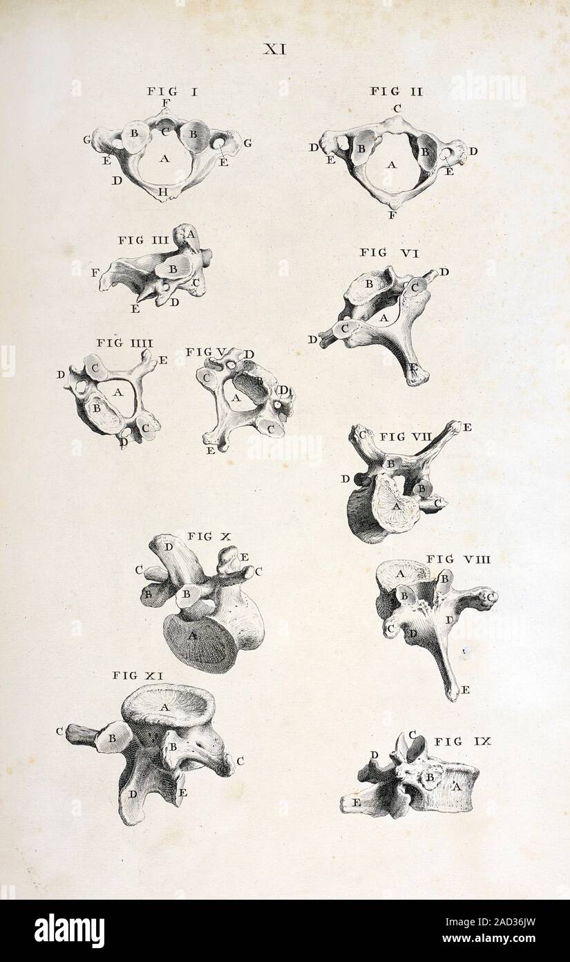 Spinal vertebrae, 18th-century illustration. At top is an atlas ...