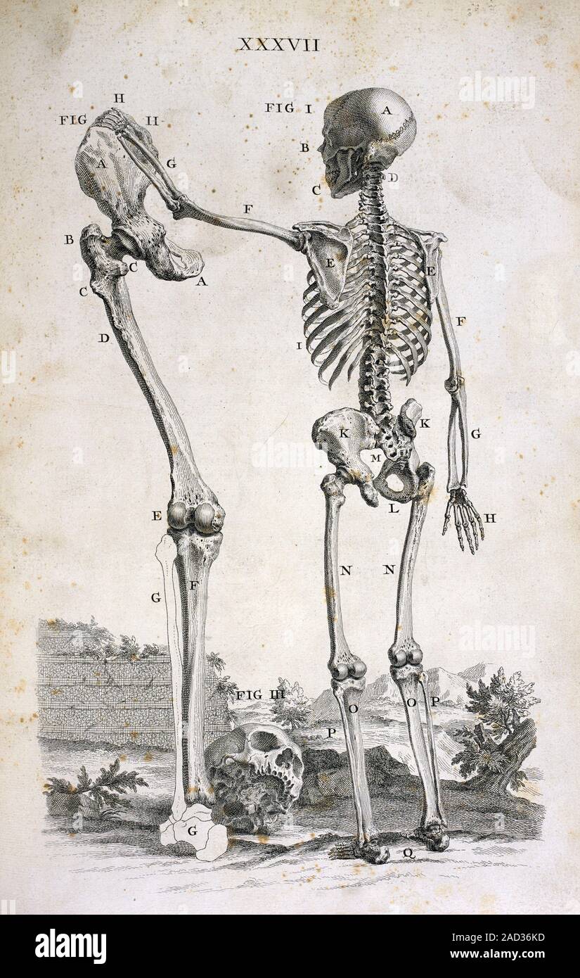 Skeleton and giant's leg, 18th-century illustration. Gigantism ...
