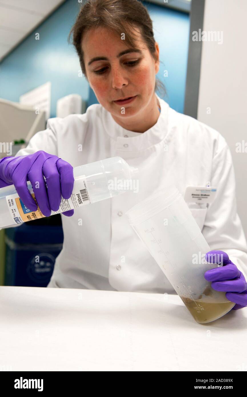 Faecal transplant preparation. A technician diluting donated human ...