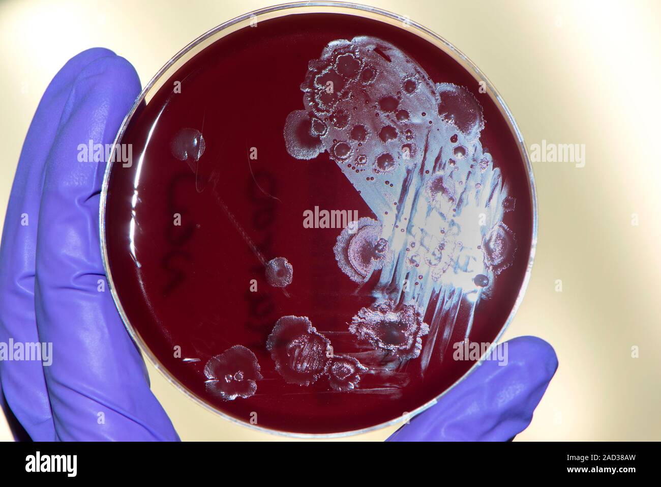 Clostridium difficile bacteria growing on agar. Infection by this ...
