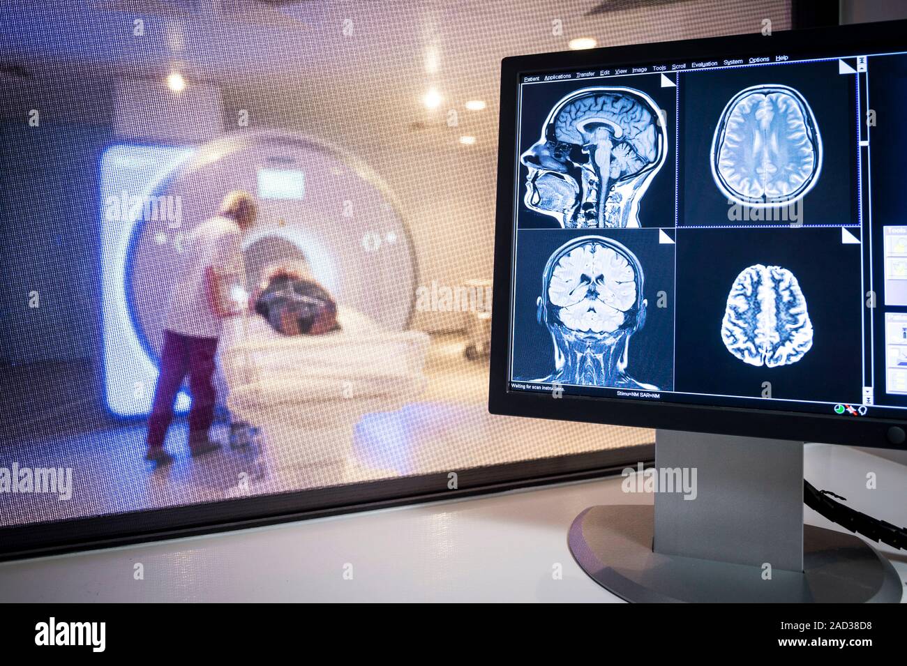 MRI scanning. Radiology staff attending a patient and who is being ...