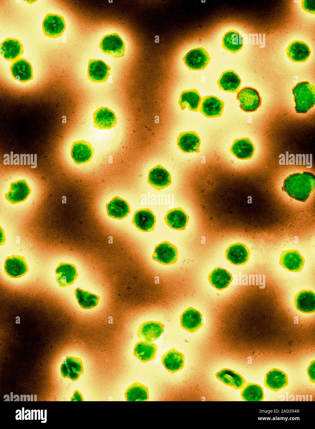 Ranavirus virus particles, coloured transmission electron micrograph ...