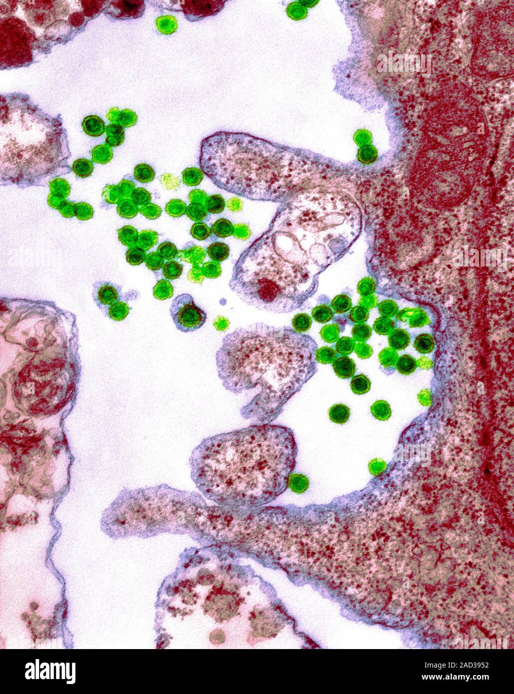 Rous sarcoma virus (RSV) infection, coloured transmission electron ...