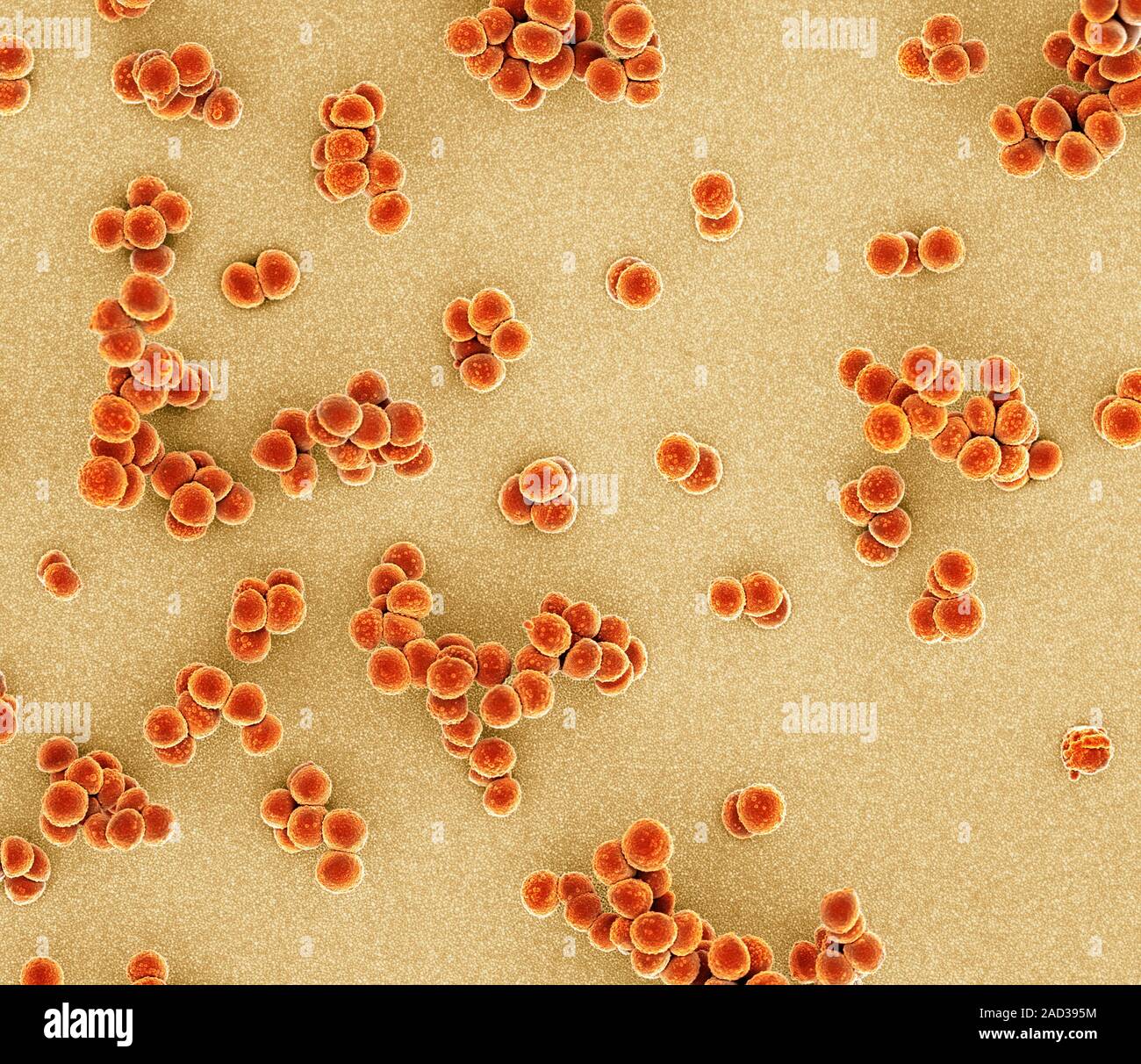 MRSA bacteria. Coloured scanning electron micrograph (SEM) of methicillin-resistant ...
