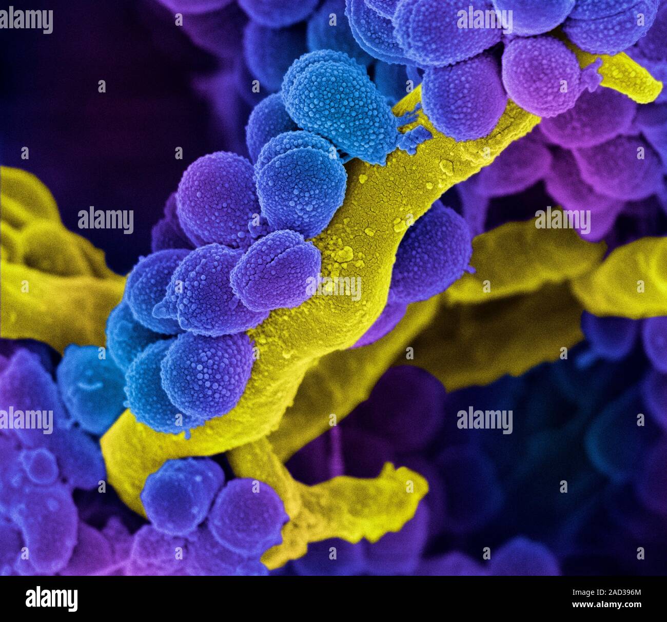 Oral Streptococcus bacteria. Coloured scanning electron micrograph (SEM ...