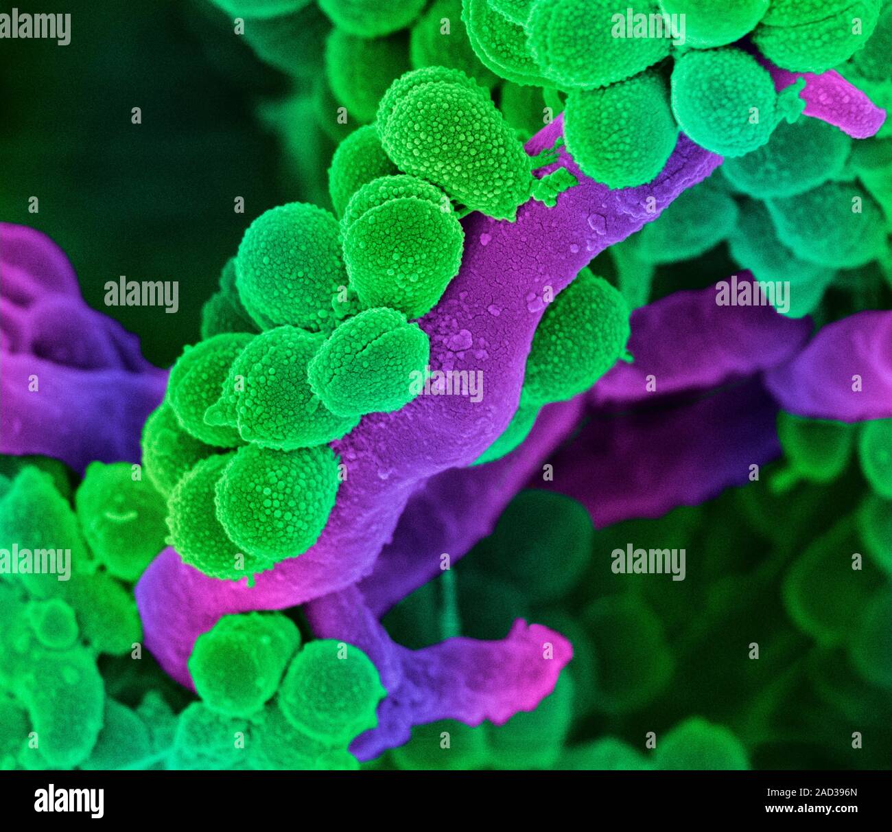 Oral Streptococcus bacteria. Coloured scanning electron micrograph (SEM ... Oral Streptococcus bacteria. Coloured scanning electron micrograph (SEM ...