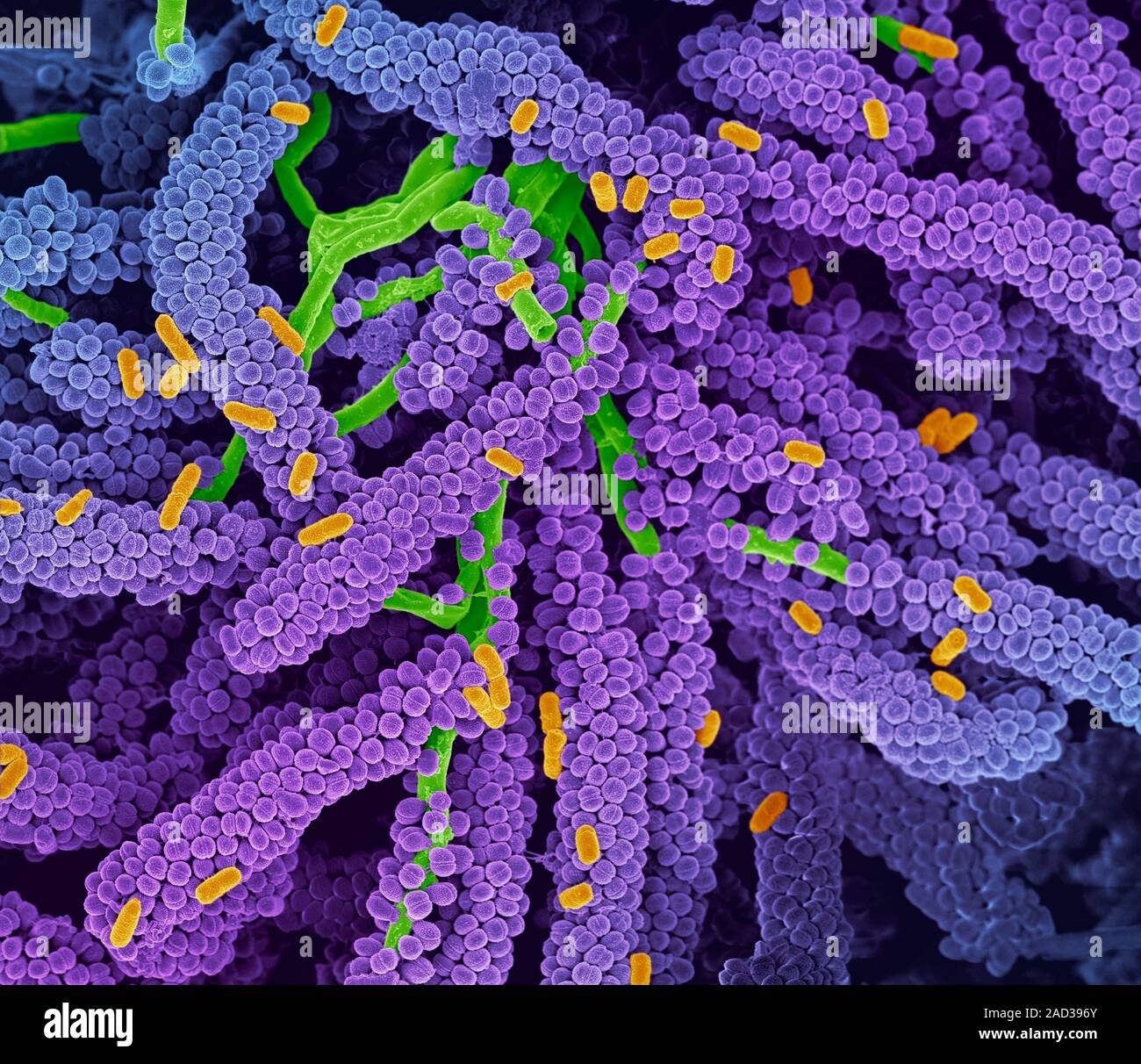 Streptococcus bacteria. Coloured scanning electron micrograph (SEM) of ...