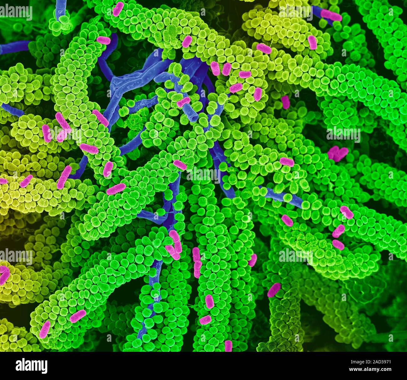 Streptococcus bacteria. Coloured scanning electron micrograph (SEM) of ...