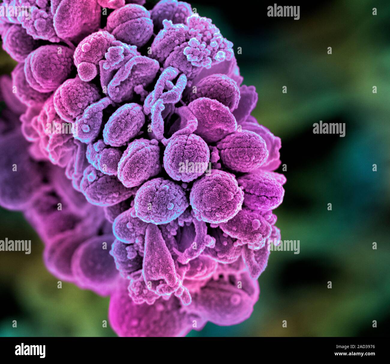 Streptococcus bacteria. Coloured scanning electron micrograph (SEM) of ...