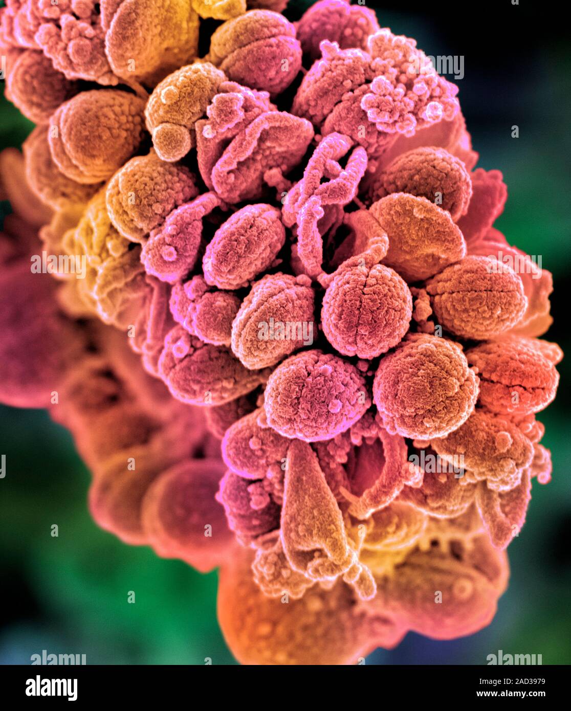 Streptococcus bacteria. Coloured scanning electron micrograph (SEM) of ...