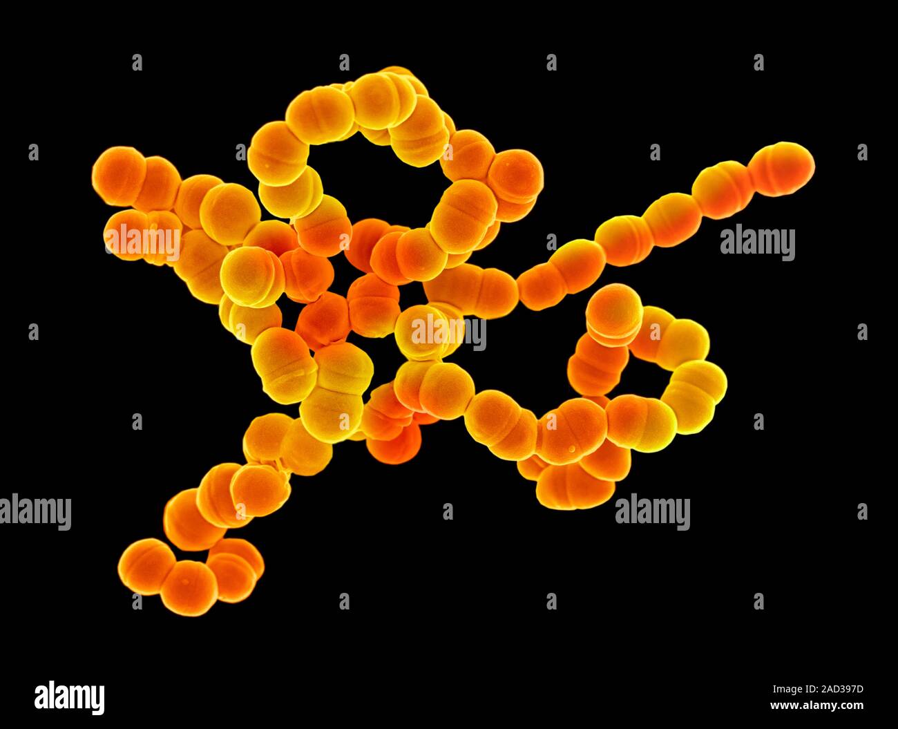 Streptococcus bacteria. Coloured scanning electron micrograph (SEM) of ...