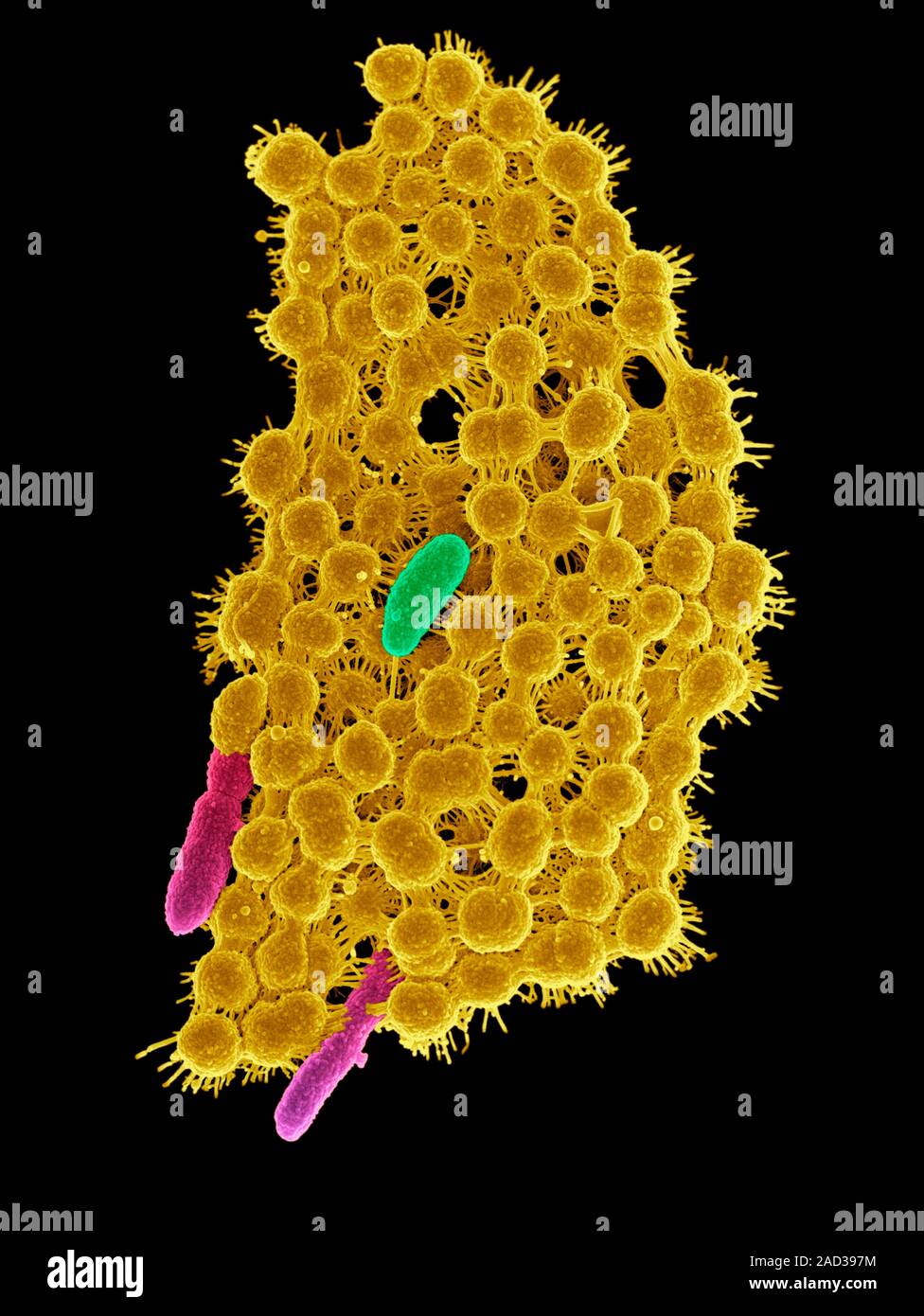 Saliva and bacteria. Coloured scanning electron micrograph (SEM) of a ...
