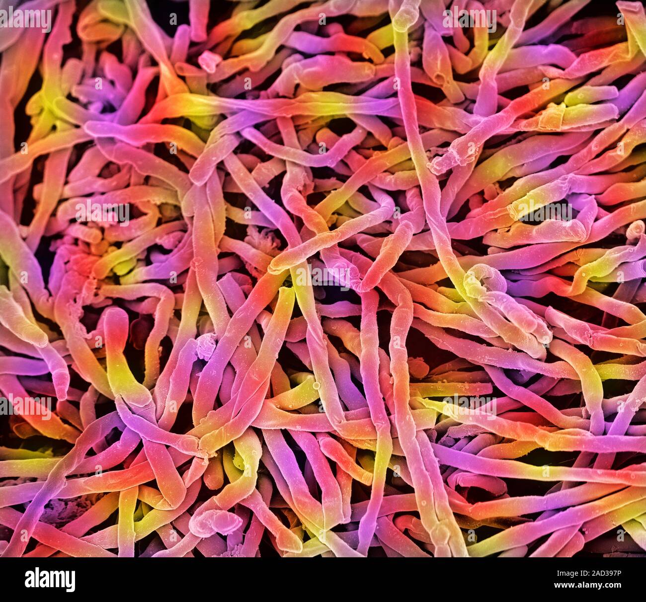 Streptomyces thermophilic bacteria. Coloured scanning electron ...
