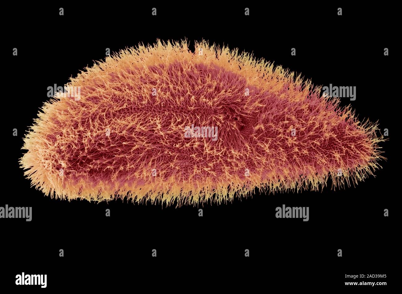 Paramecium protozoan. Coloured scanning electron micrograph (SEM) of a ...