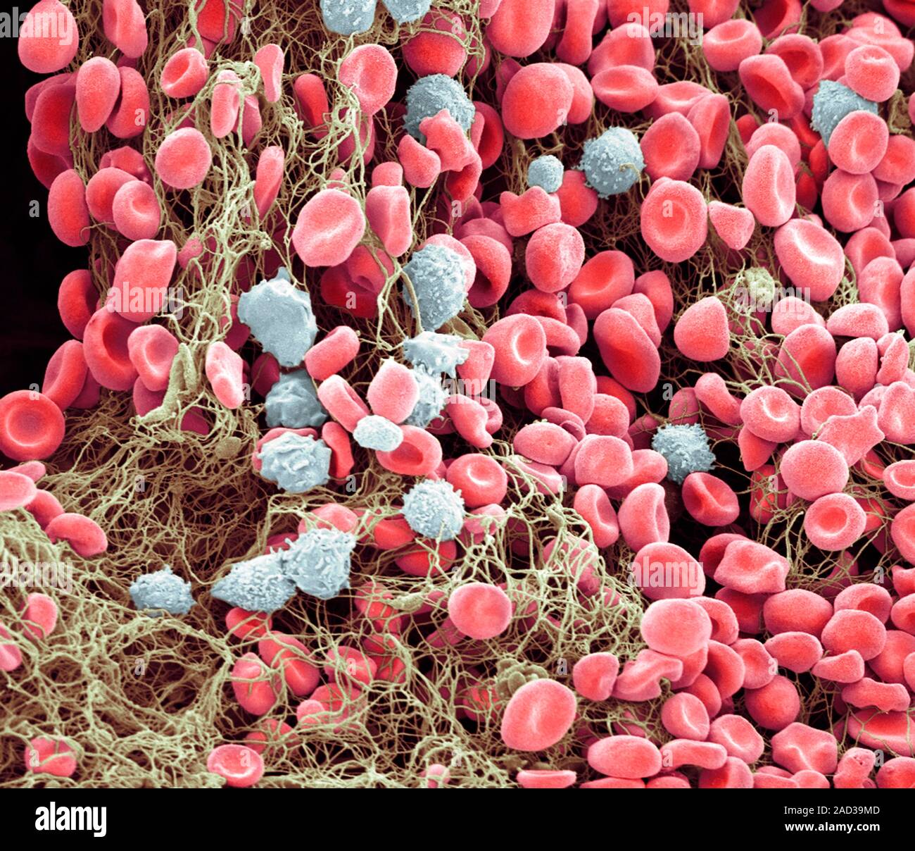 Bone marrow. Coloured scanning electron micrograph (SEM) of bone marrow ...