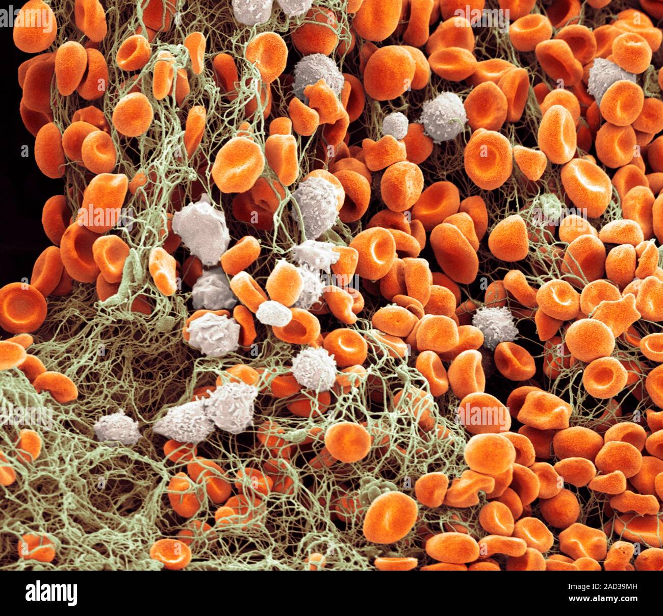 Bone marrow. Coloured scanning electron micrograph (SEM) of bone marrow ...