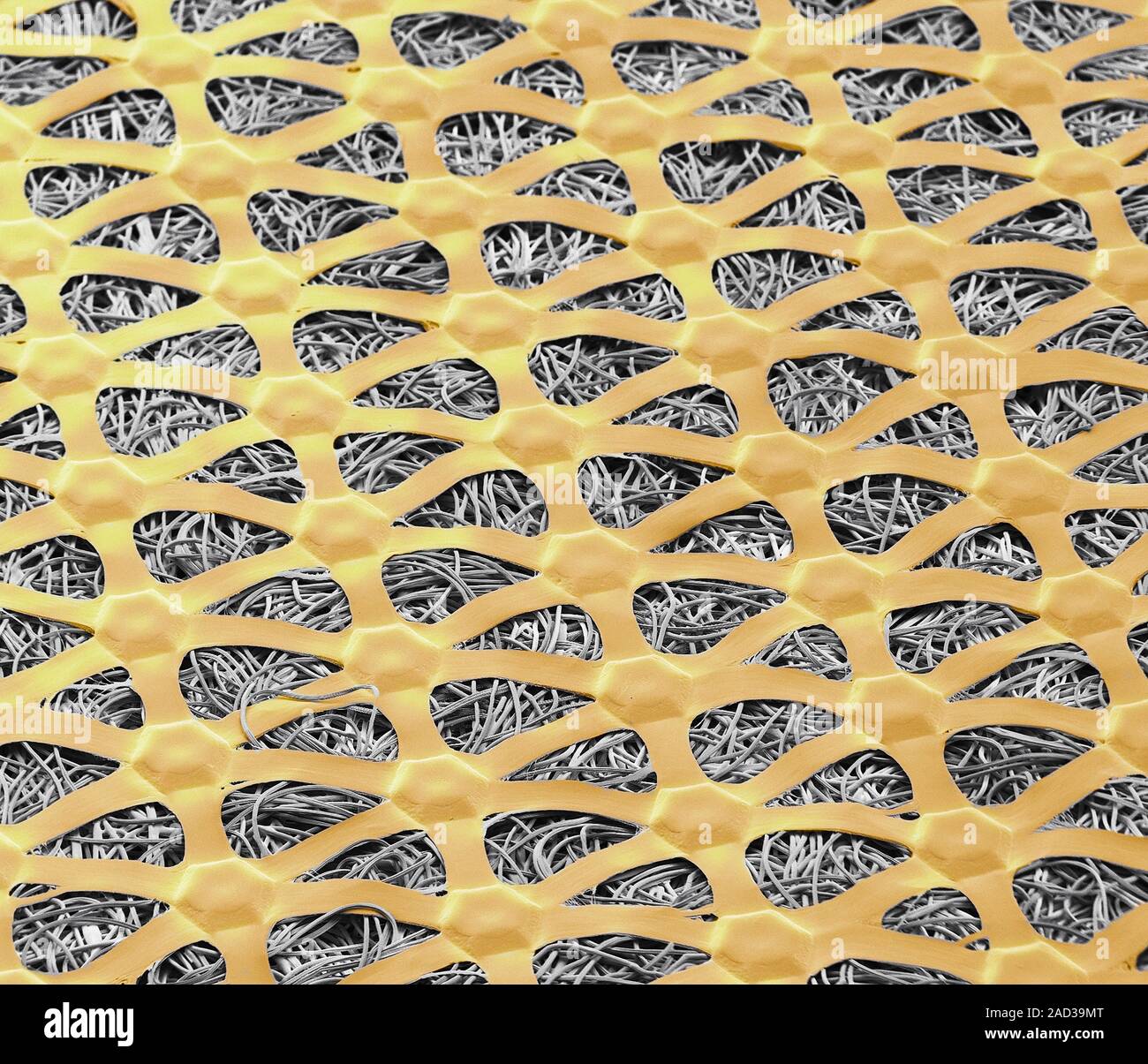 Silver plaster technology, coloured electron micrograph (SEM). Nano ...