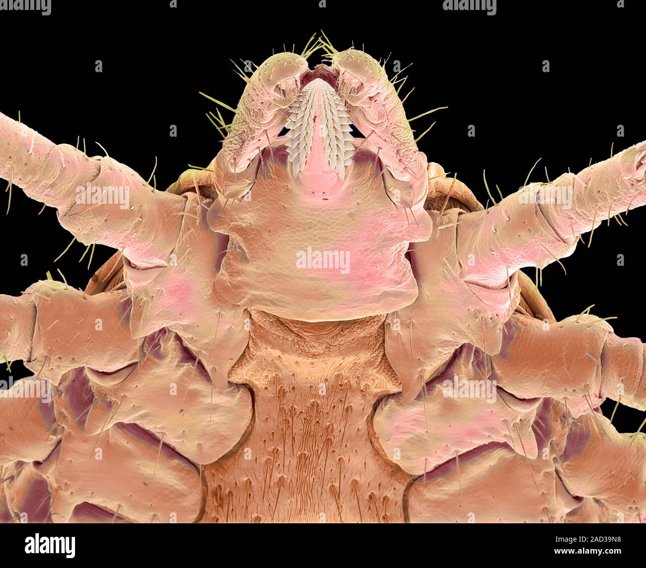 Tick. Coloured scanning electron micrograph (SEM). This is the ventral ...
