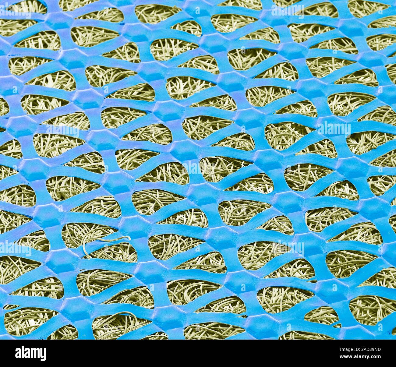 Silver plaster technology, coloured electron micrograph (SEM). Nano ...