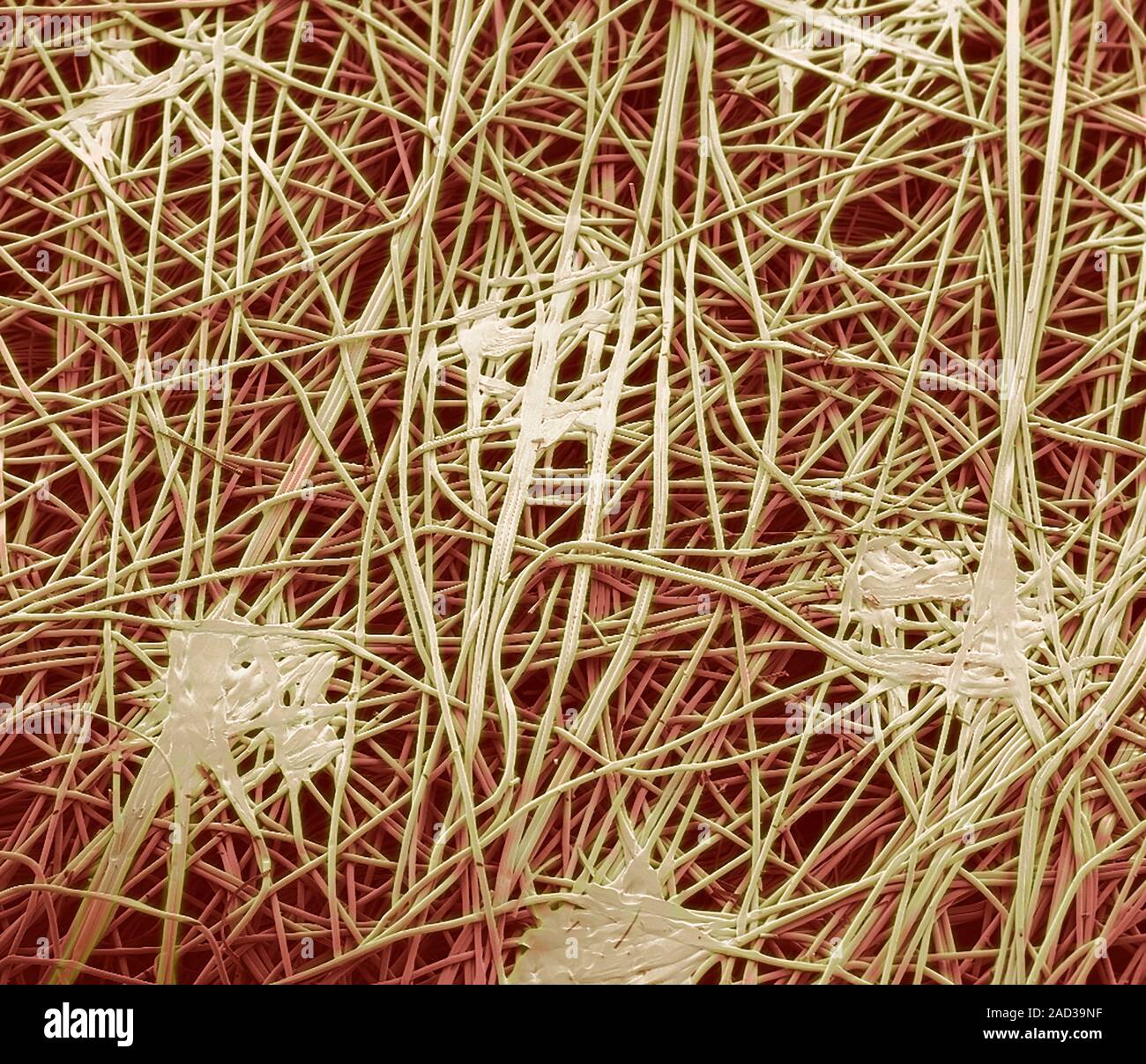 Silver wound dressing technology. Coloured electron micrograph (SEM ...