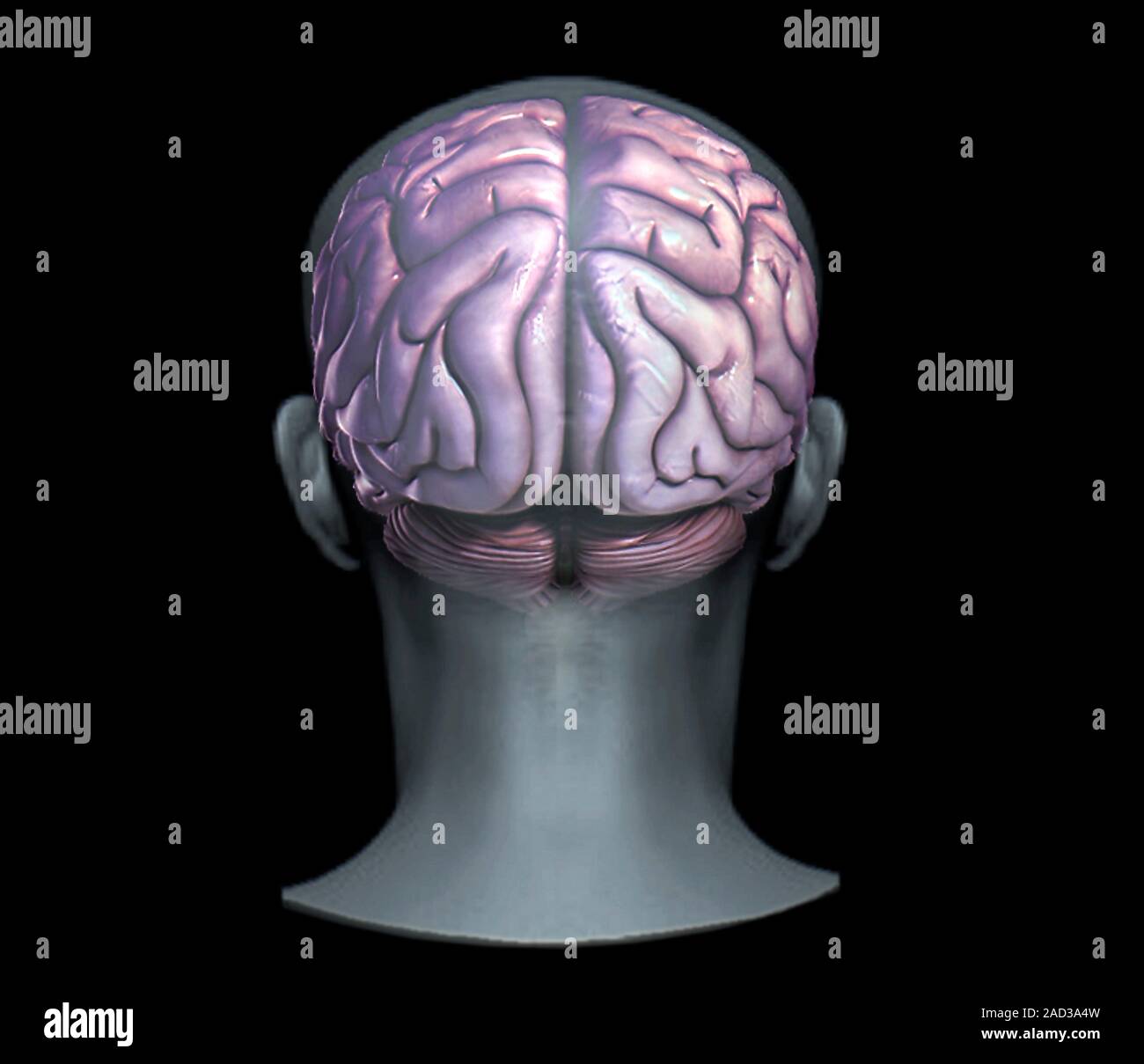 Normal brain. 3D magnetic resonance imaging (MRI) scan of the head of a ...