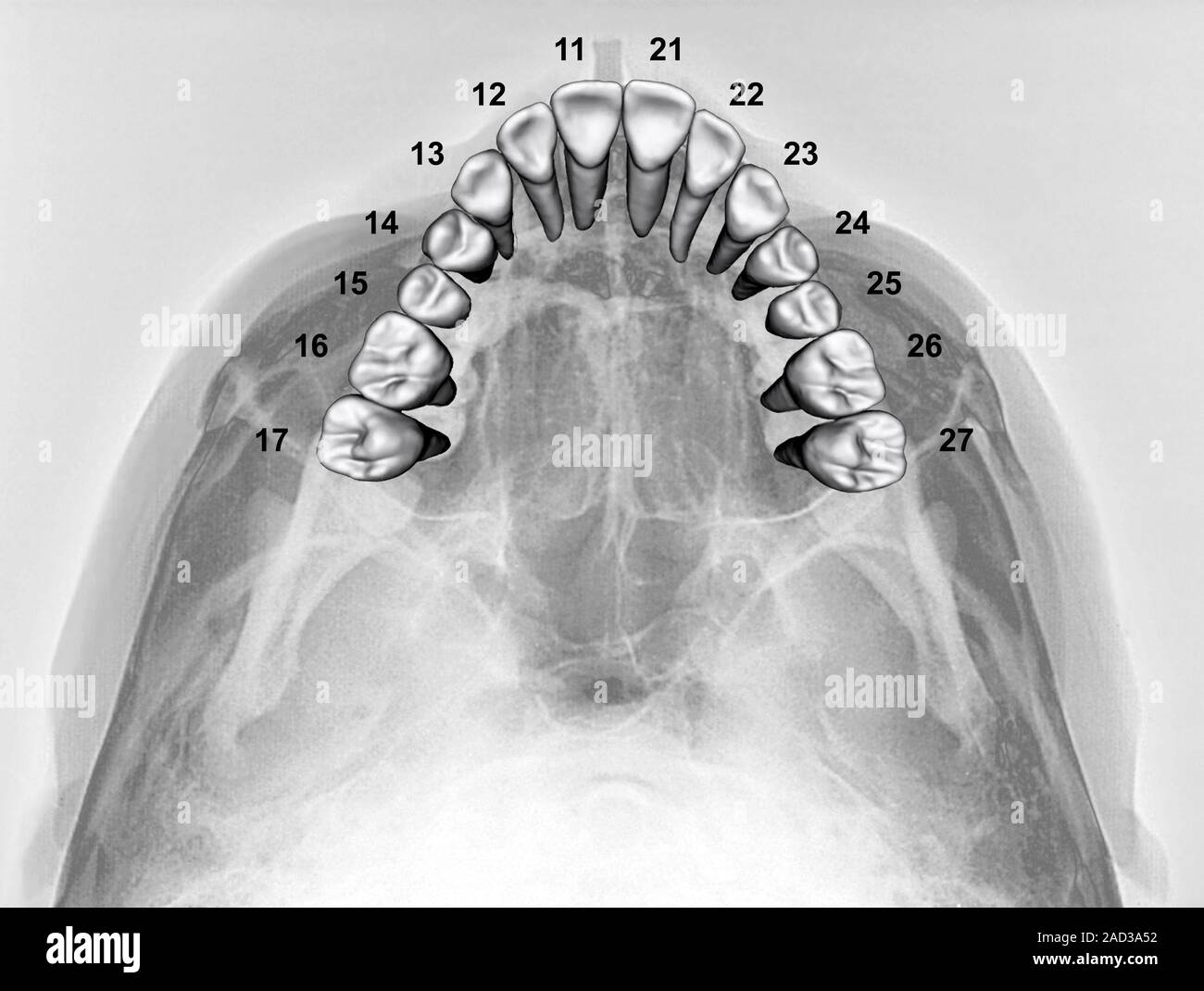 Normal teeth. 3D cone beam computed tomography (CBCT) scan of the ...