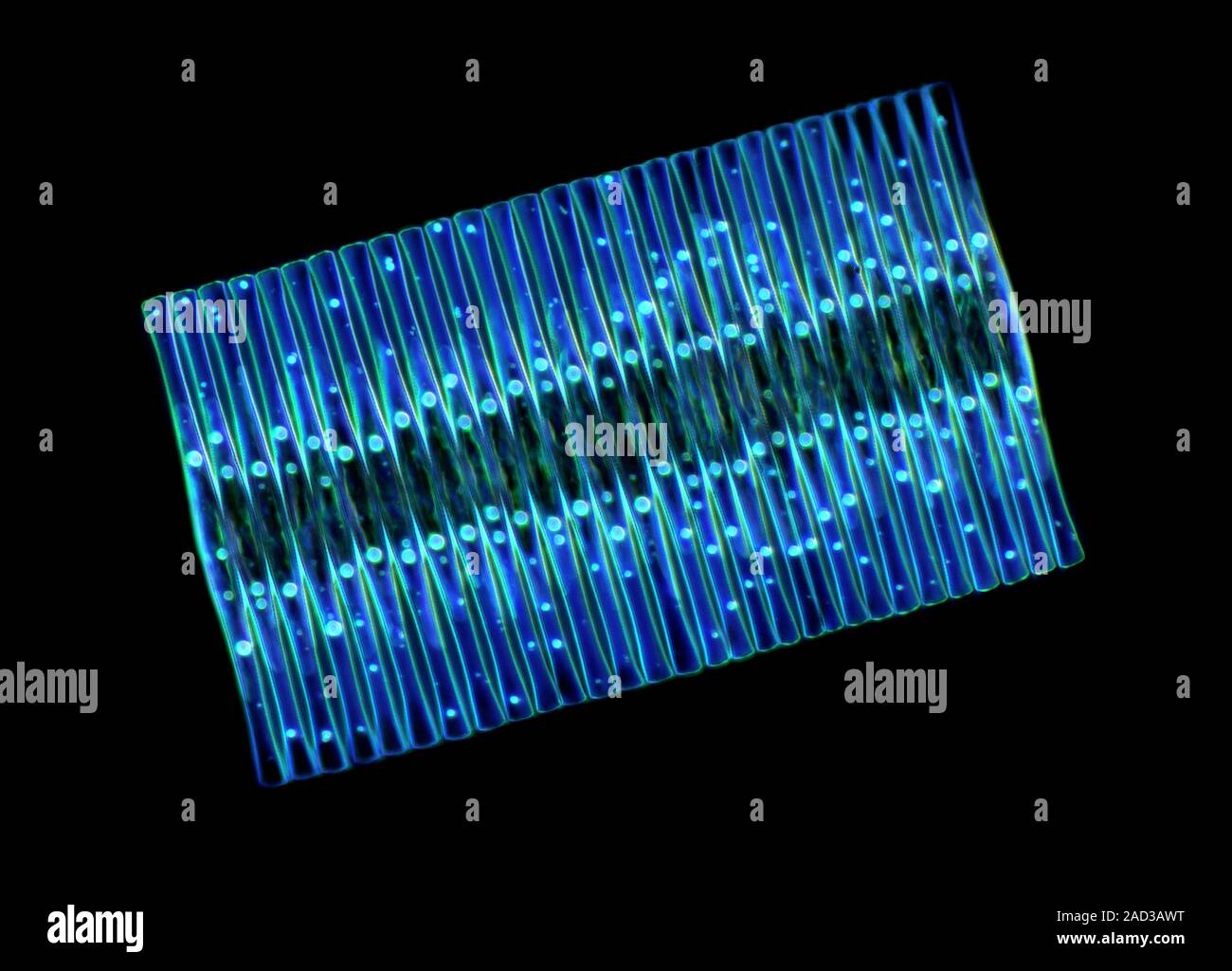 Fragilaria diatoms. Darkfield illuminated polarised light micrograph of ...