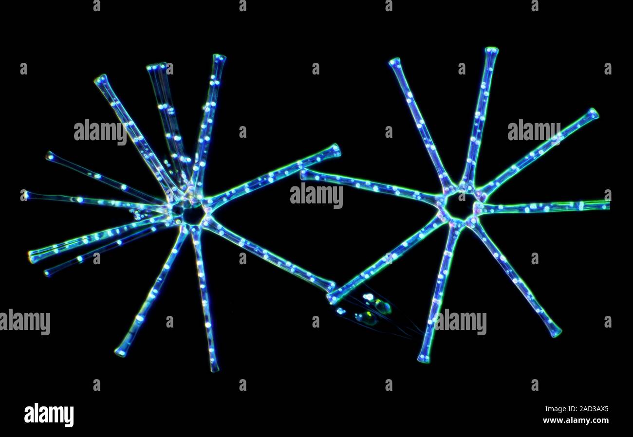 Asterionella diatoms. Darkfield illuminated polarised light micrograph ...
