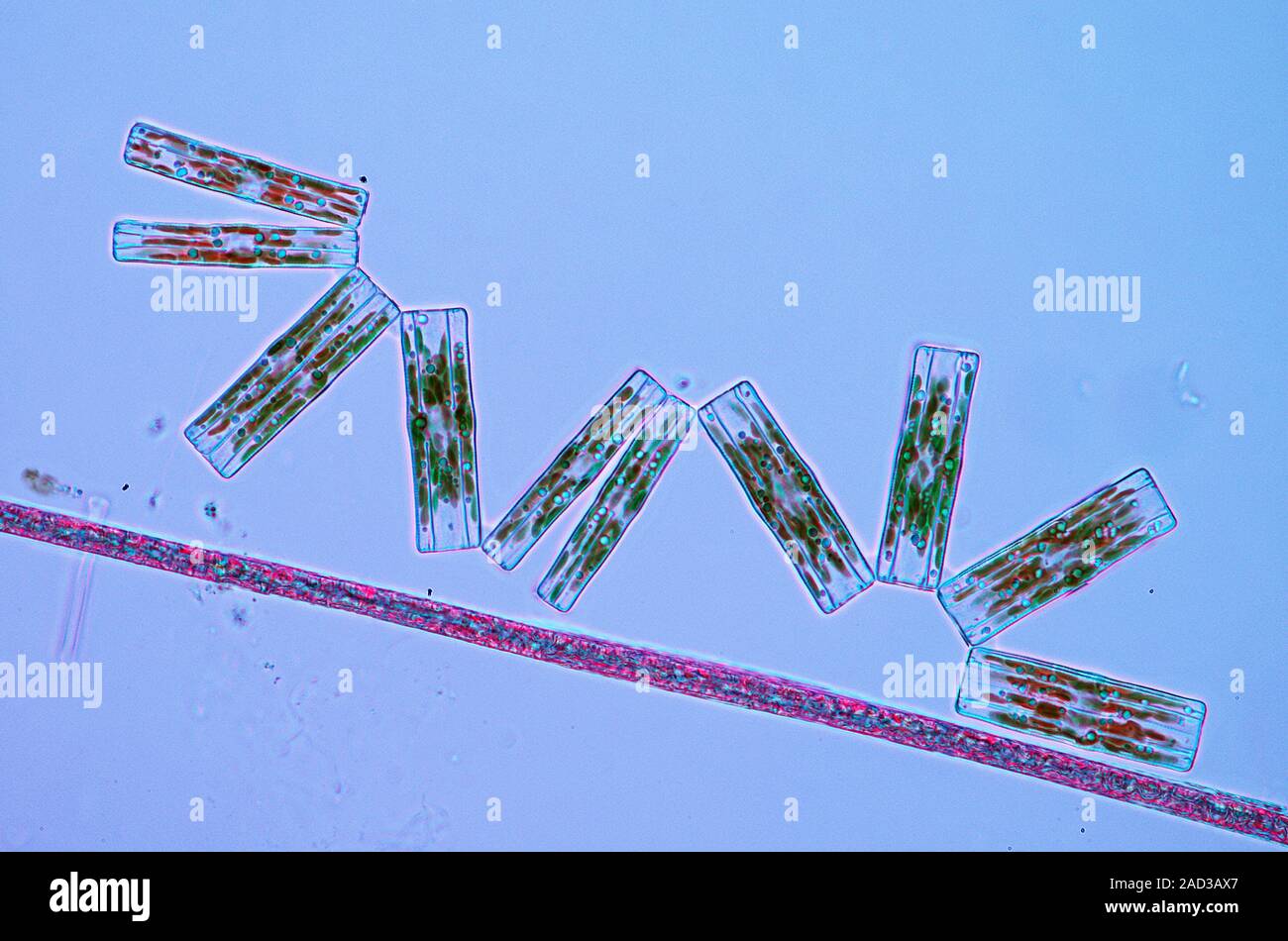 Diatoms and cyanobacteria. Polarised light micrograph of Diatoma sp ...