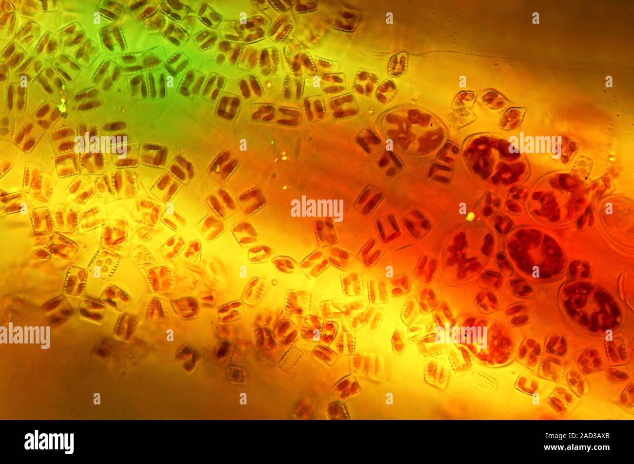 Diatoms. Polarised light micrograph of Diatoma sp. (square) and ...
