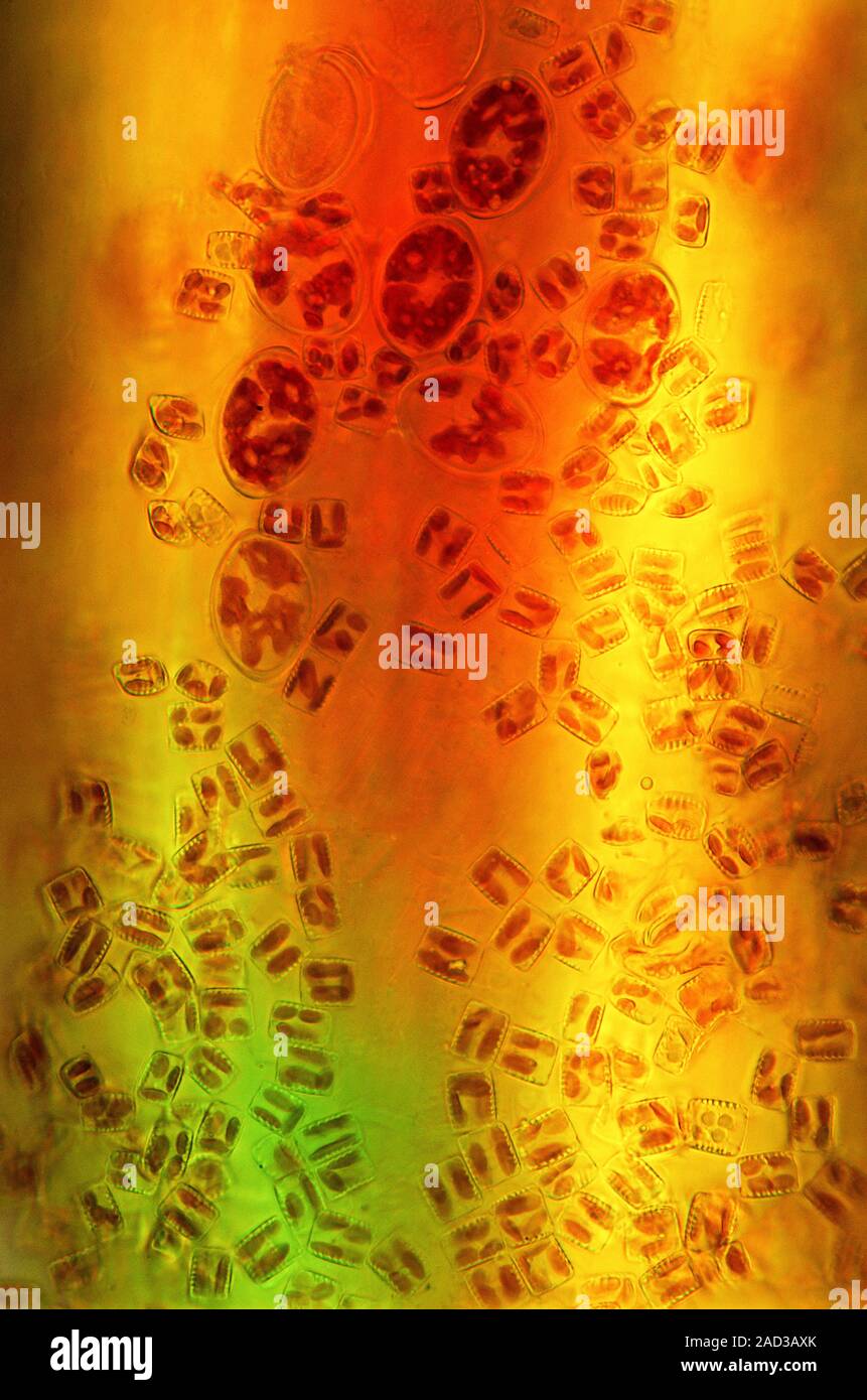 Diatoms. Polarised light micrograph of Diatoma sp. (square) and ...