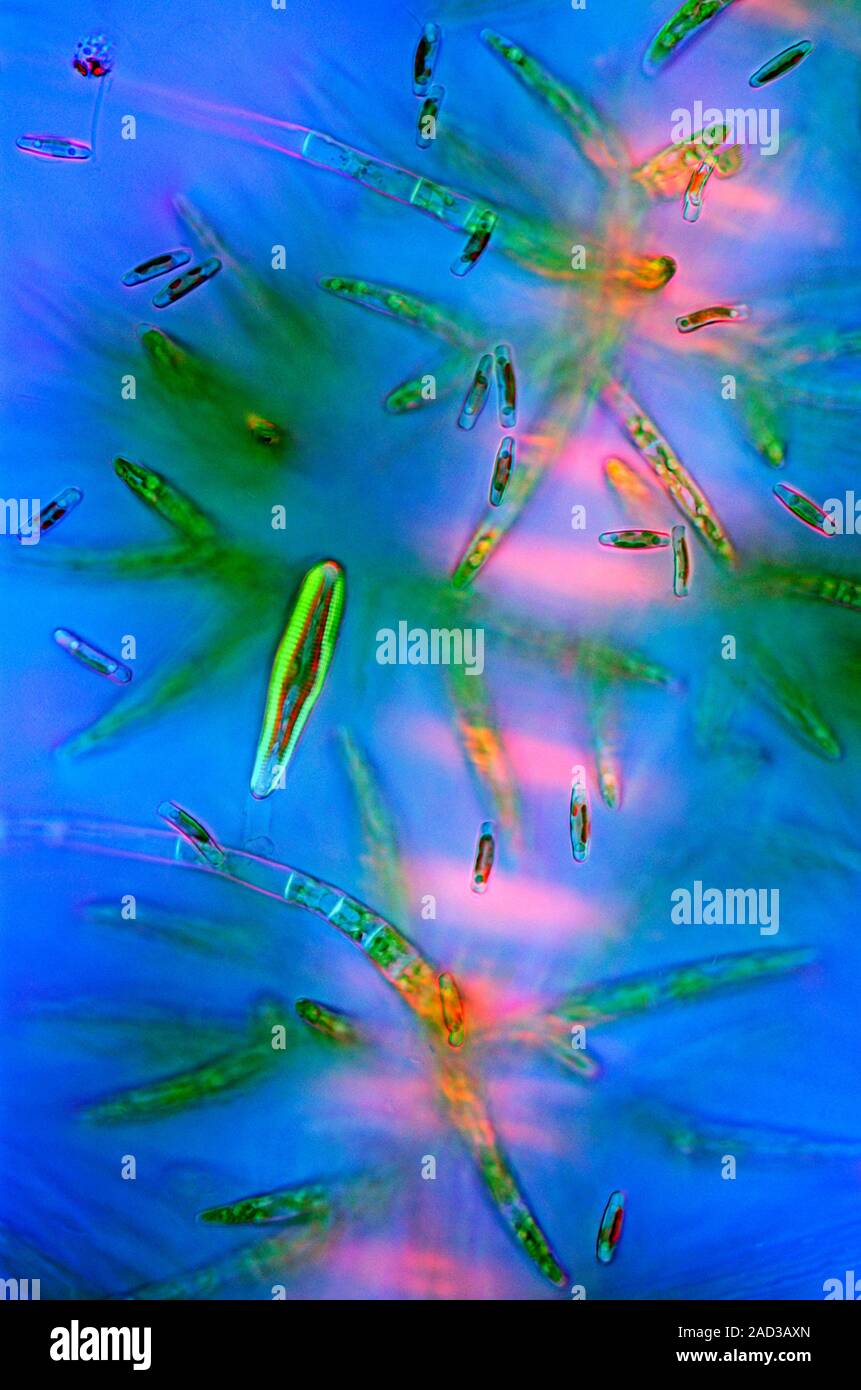 Diatoms. Polarised light micrograph of diatoms (oval) between ...