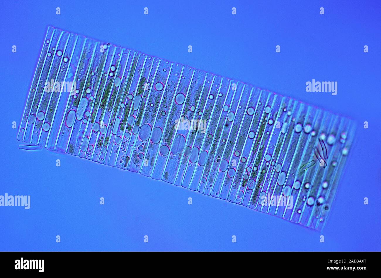 Fragilaria diatoms. Polarised light micrograph of Fragilaria sp ...