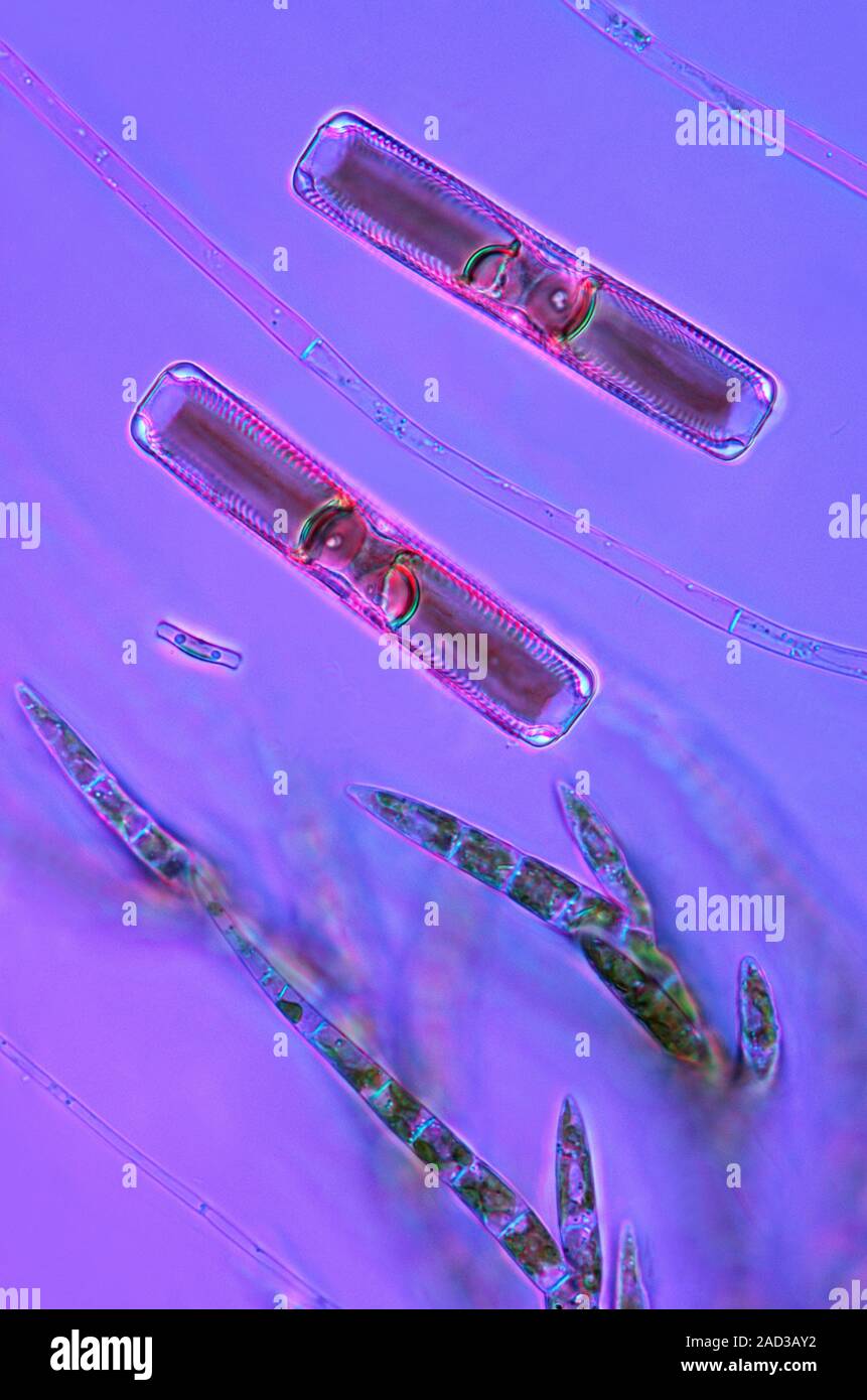 Diatom. Polarised light micrograph of a diatom (rectangular) between ...