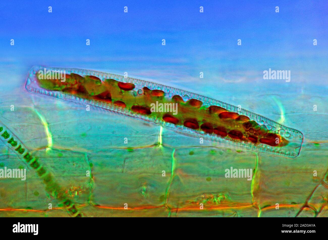 Epithemia diatom. Polarised light micrograph of an Epithemia sp. diatom ...